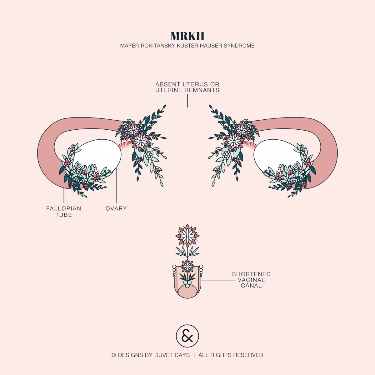 What is MRKH? – MRKH Connect
