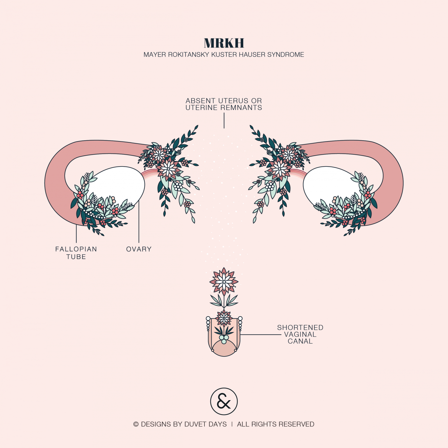 What is MRKH? – MRKH Connect